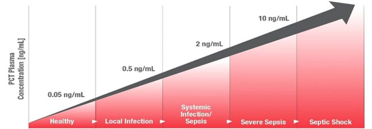 Procalcitonina (PCT) no Diagnóstico de Doenças Infecciosas - Methodos ...